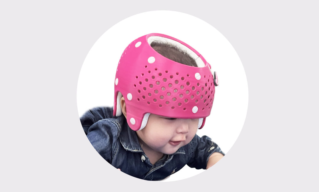 ACEBAND - Correction Procedure